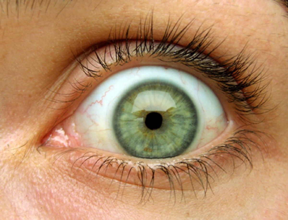 Ela, Kehribar, Bal ve Daha Fazlası! Göz Rengini Tam Olarak Söylemek ...