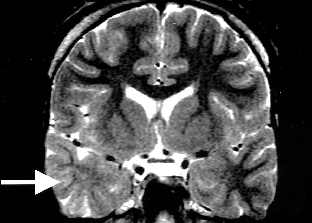 12 Madde İle Ruh Molekülü: DMT - Onedio