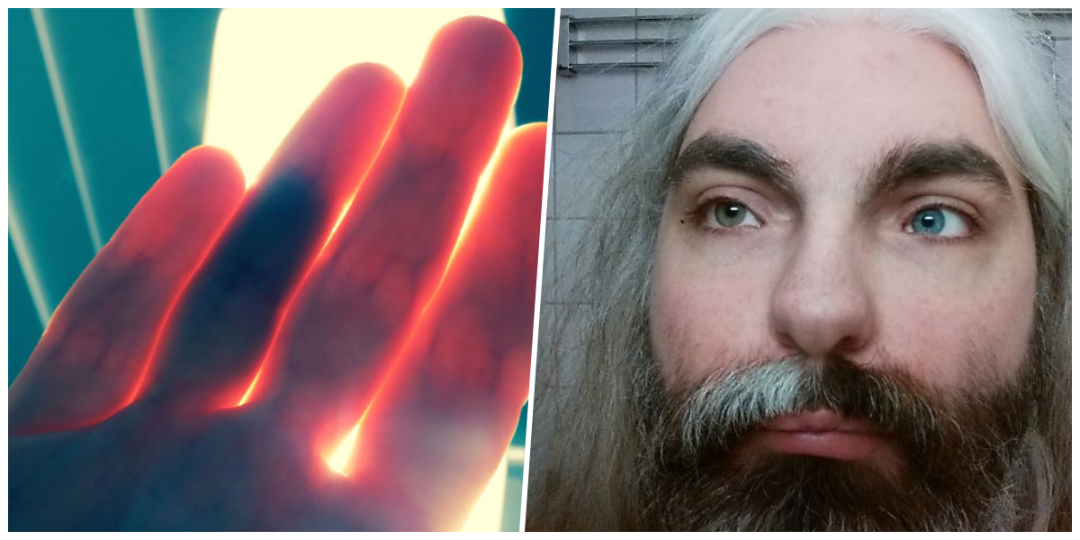 30 Extraordinary People Who Were Born With Unique Traits