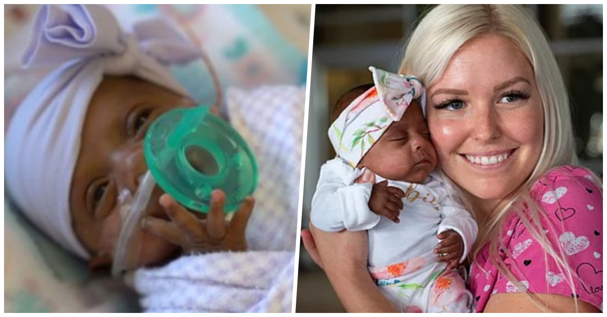Dünyanın En Küçük Bebeği Saybie Hayata Tutunma Mücadelesini Kazandı ve ...