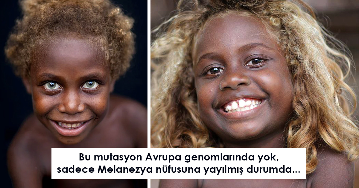 Tek Bir Mutasyonun Sebep Olduğu Benzersiz Güzellik: Dünyanın Tek Doğal ...