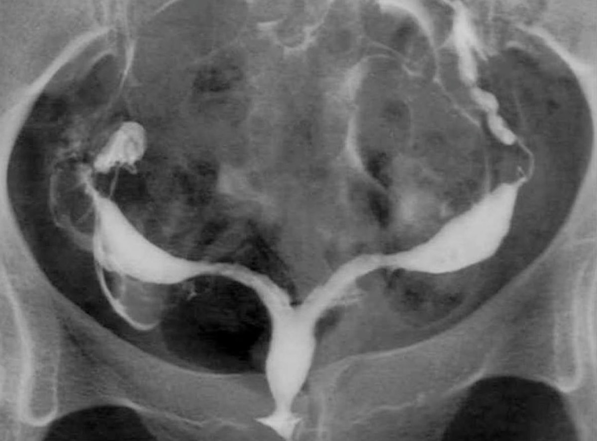 Rahim Filmi Nasıl Çekilir? - Onedio