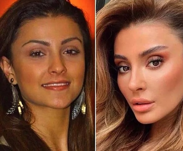 Çok Estetik Annecim: Hande Erçel'den Demet Özdemir'e Kadar Estetik ...