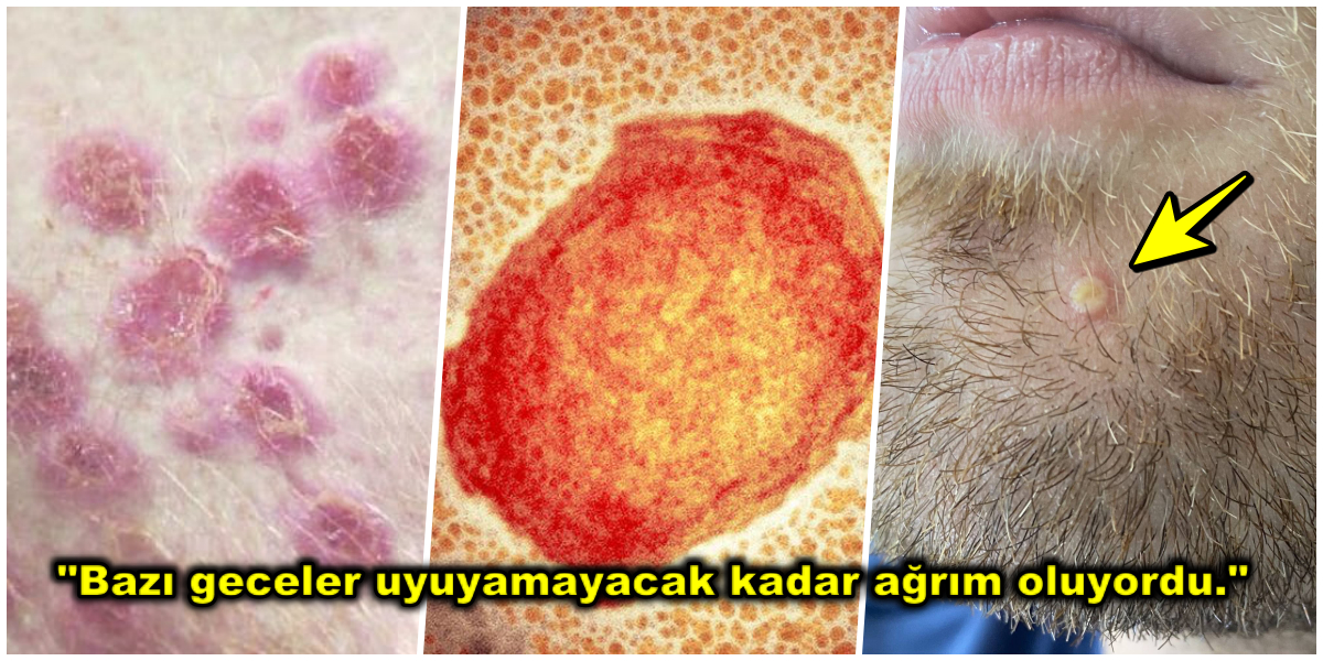 Maymun Çiçeğine Yakalanan Adam - Onedio