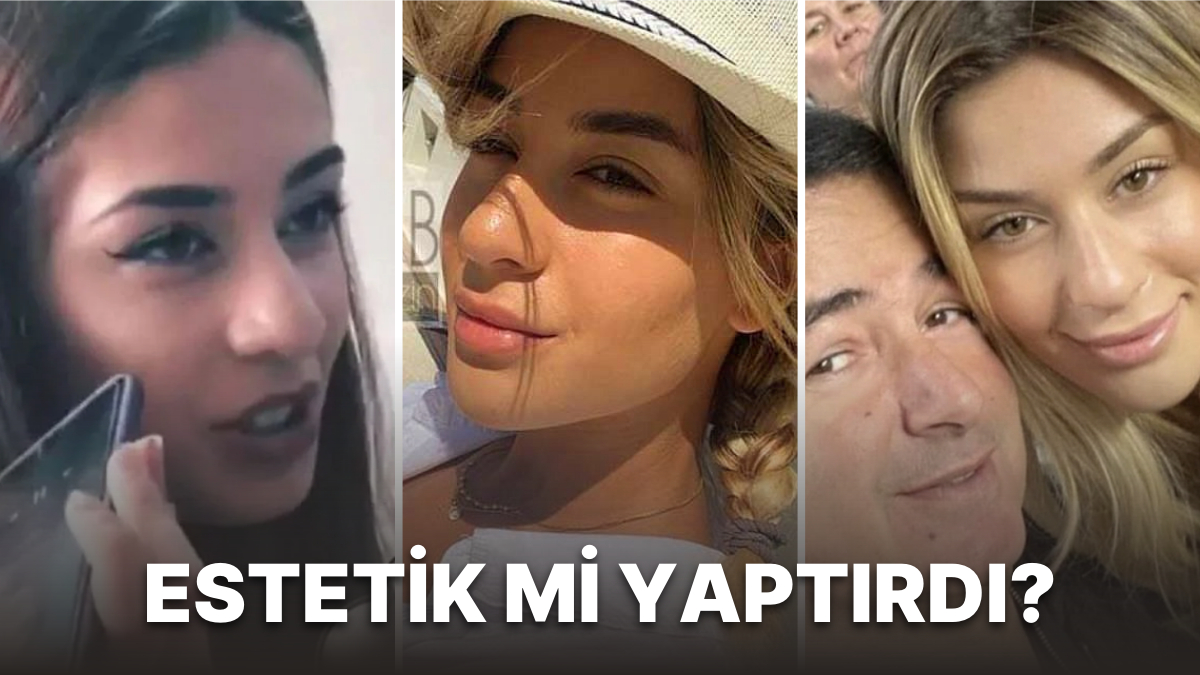 Acun Ilıcalı'nın Sevgilisi Ayça Çağla'nın Değişimi - Onedio