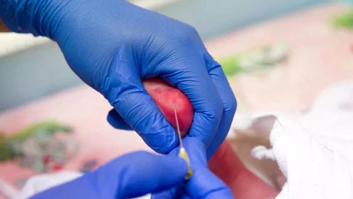 Kistik Fibrozis Kimlerde Görülür? - Onedio