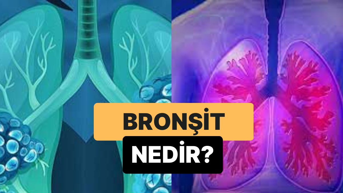 Bronşların Birtakım Engeller Nedeniyle İnflamasyonu: Bronşit Nedir ...