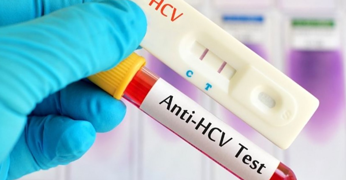 Anti HCV Nedir? - Onedio