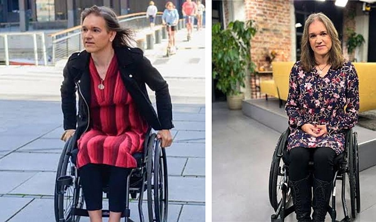 Kendini Engelli Bir Kadın Olarak Tanımladı - Onedio