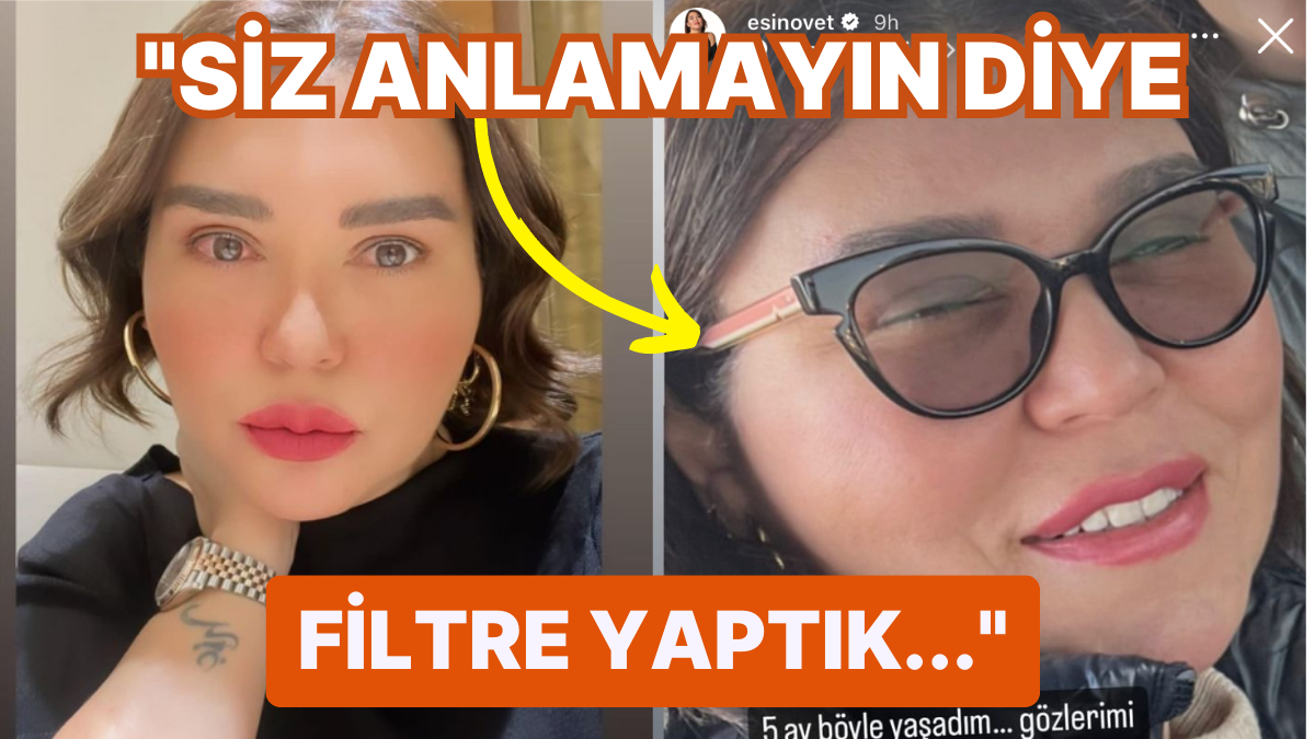 Gazeteci Esin Övet Estetik Kurbanı Oldu - Onedio