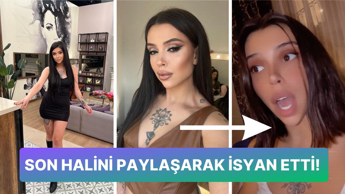 Simge Nur Erkoç Estetik Doktoruna Dava Açtı! - Onedio