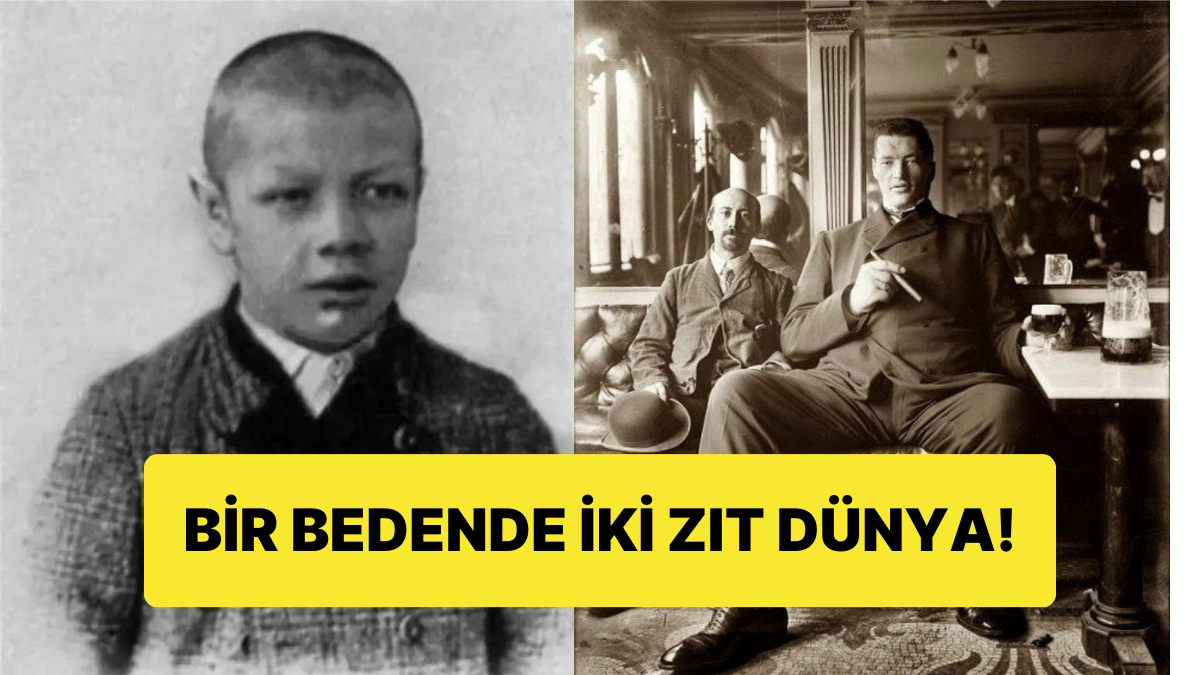 Cüce Olarak Dünyaya Geldikten Sonra Dev Hastalığına Yakalanan Adam ...