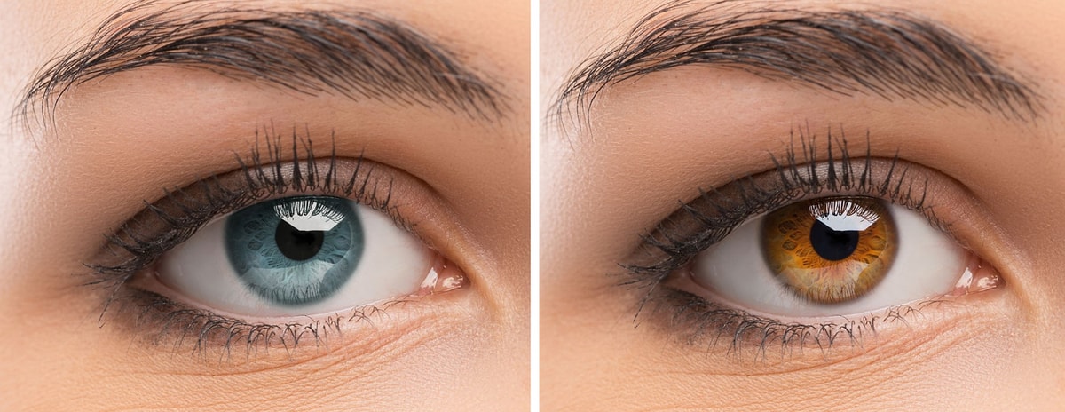 Corneal Tattooing: The Risks of Eye Color Changing Procedures - Onedio