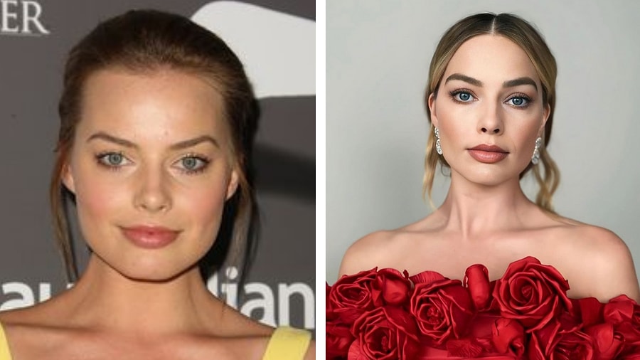 Estetik Ameliyatın Gücünü Kanıtlayan Kadınlar - Onedio