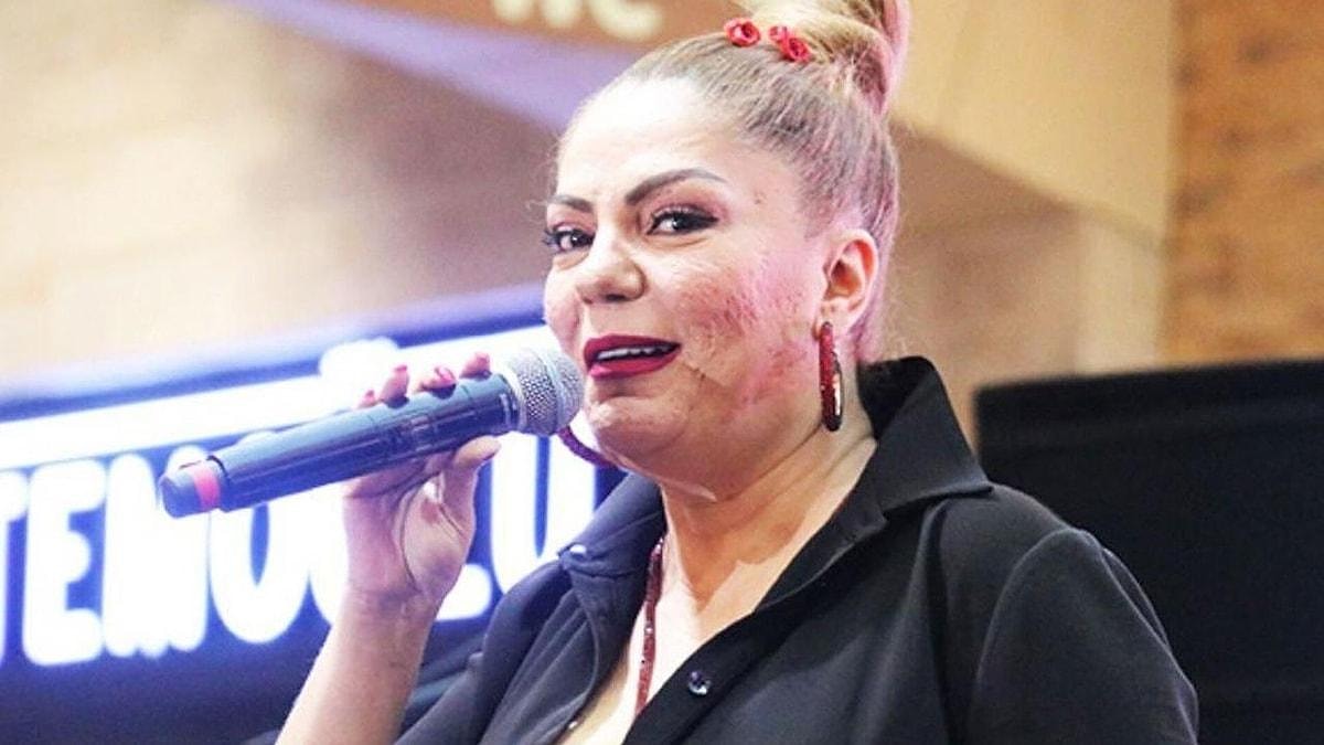 İzel'in Yüzündeki İzlerin Nedenini Anlatıyoruz! - Onedio