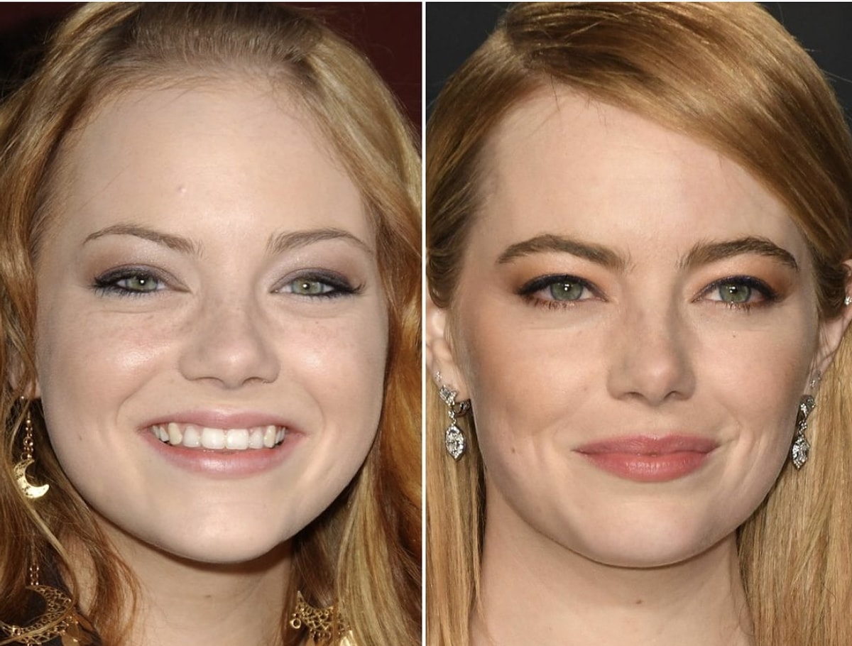 Bir Yıldız Kolay Yetişmiyor: Güzelliğiyle Büyüleyen Emma Stone'un ...