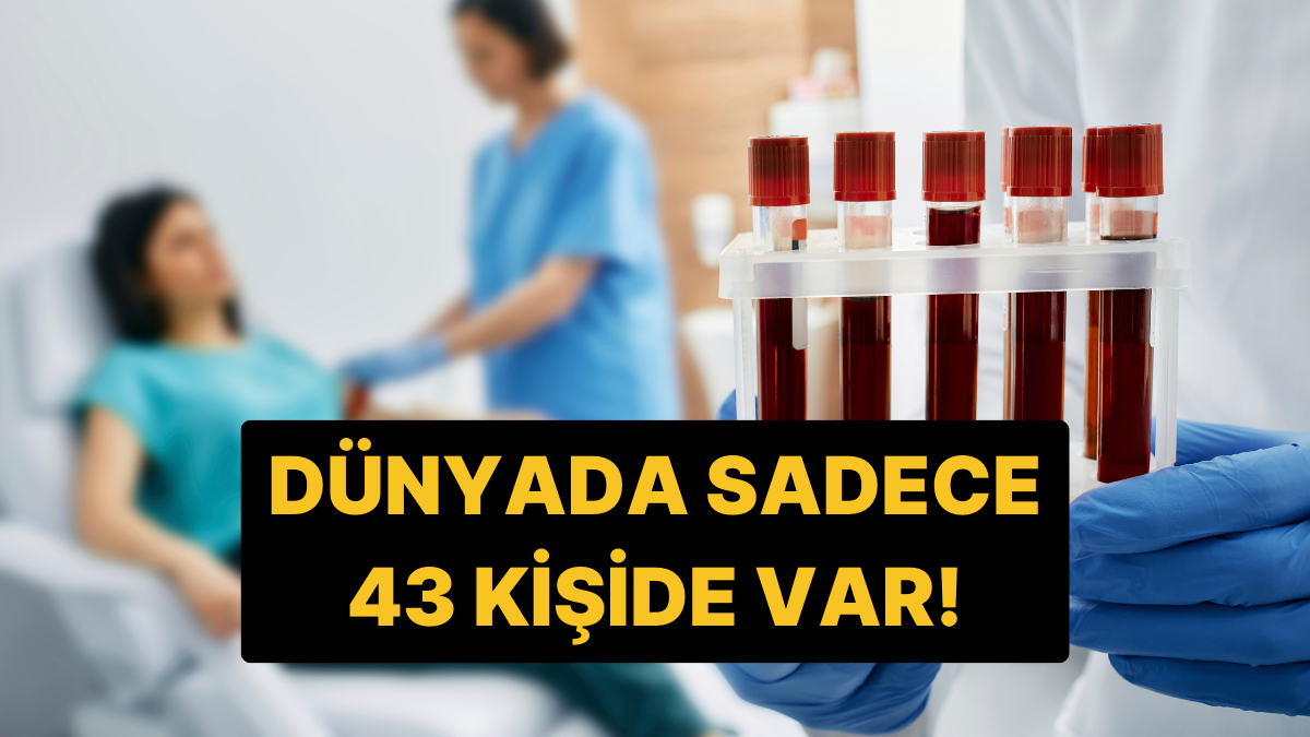 Altın Kan Grubu Nedir, Türkiye'de Var mı? Altın Kan Rengi - Onedio