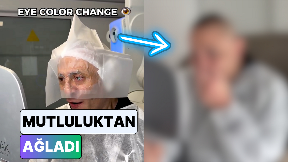 Göz Rengi Değiştirme Operasyonu Geçiren Adamın Mutluluğu - Onedio